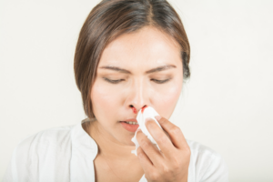 Understanding Epistaxis (Nosebleeds): Causes, Symptoms, Treatment, and ...